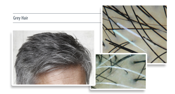 HAIR & SCALP PROBLEMS – Halabo